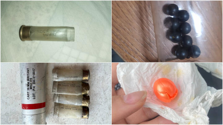 How Iran’s security forces are shooting to kill with ‘non-combat’ shotgun shells