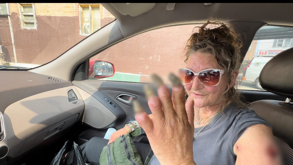 In Philadelphia, skin-rotting drug ‘tranq’ invades a neighbourhood ...