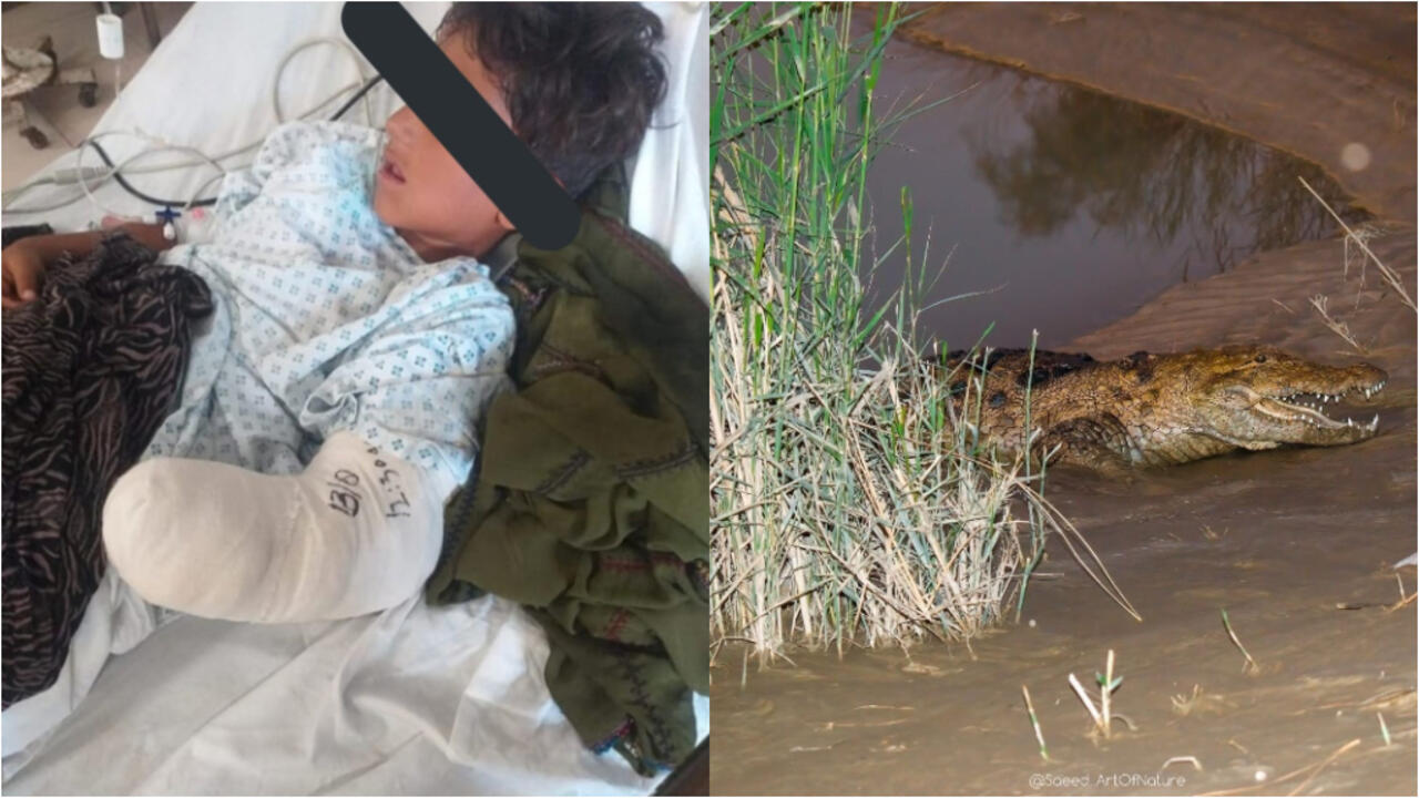 Iran: 7-year-old boy is latest child to lose arm to crocodile while ...