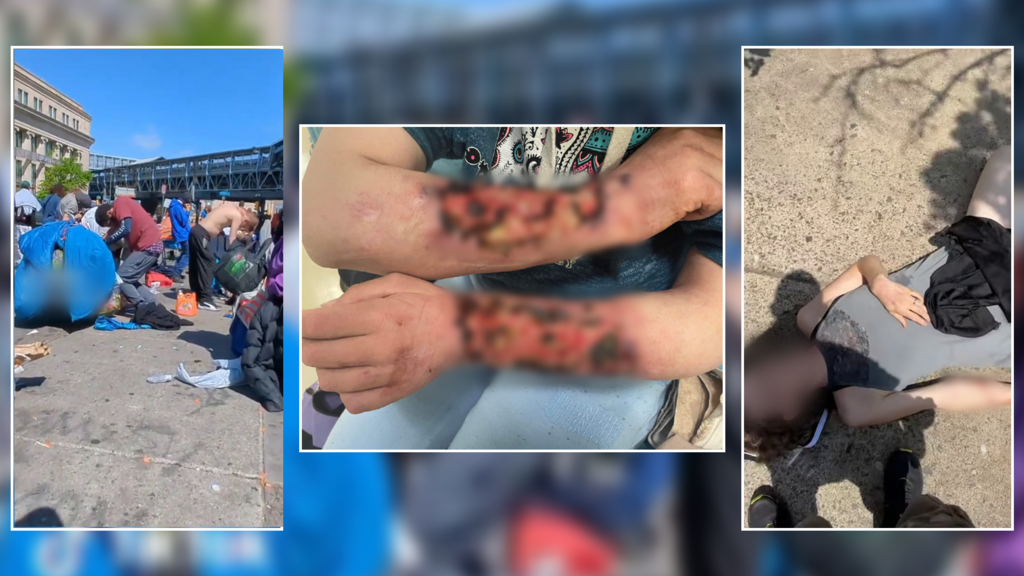 In Philadelphia, skin-rotting drug ‘tranq’ invades a neighbourhood ...