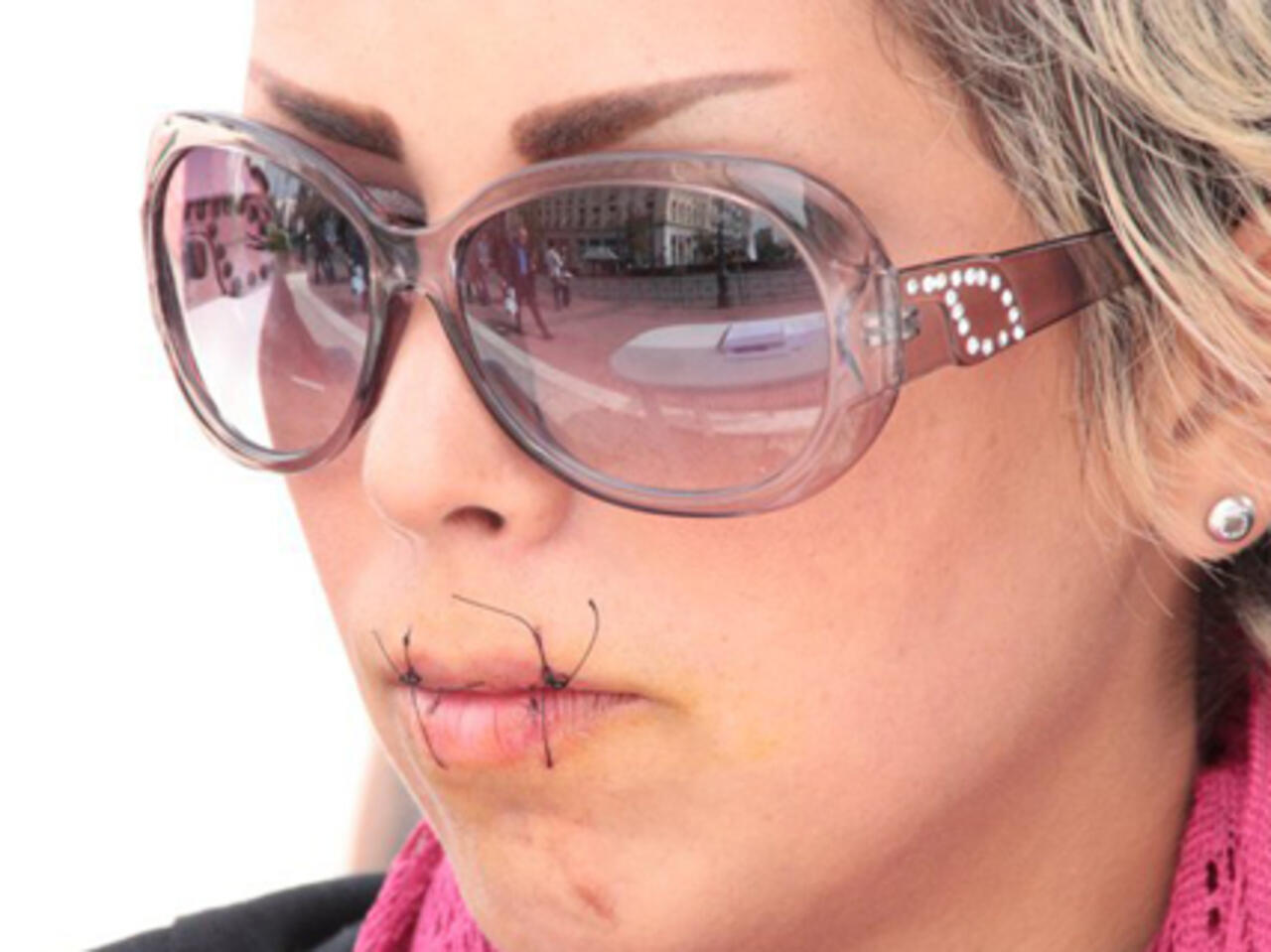 Asylum Seekers Sewing Lips Together | Lipstutorial.org