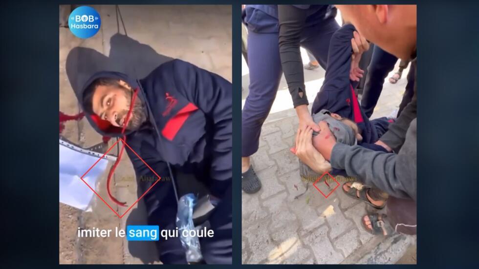 Homme brûlé à Gaza : pourquoi les accusations de mise en scène ne ...